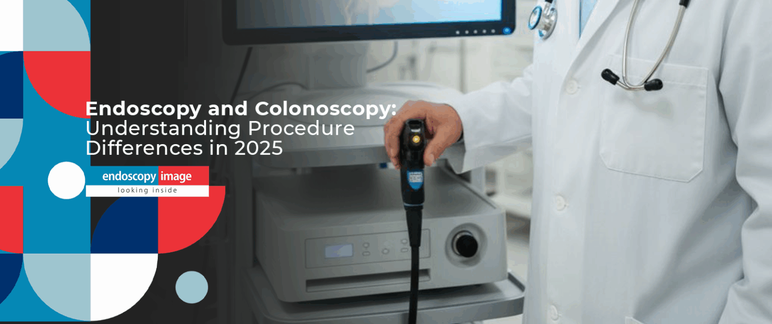 Endoscopy and Colonoscopy: The Complete Guide to Understanding ...